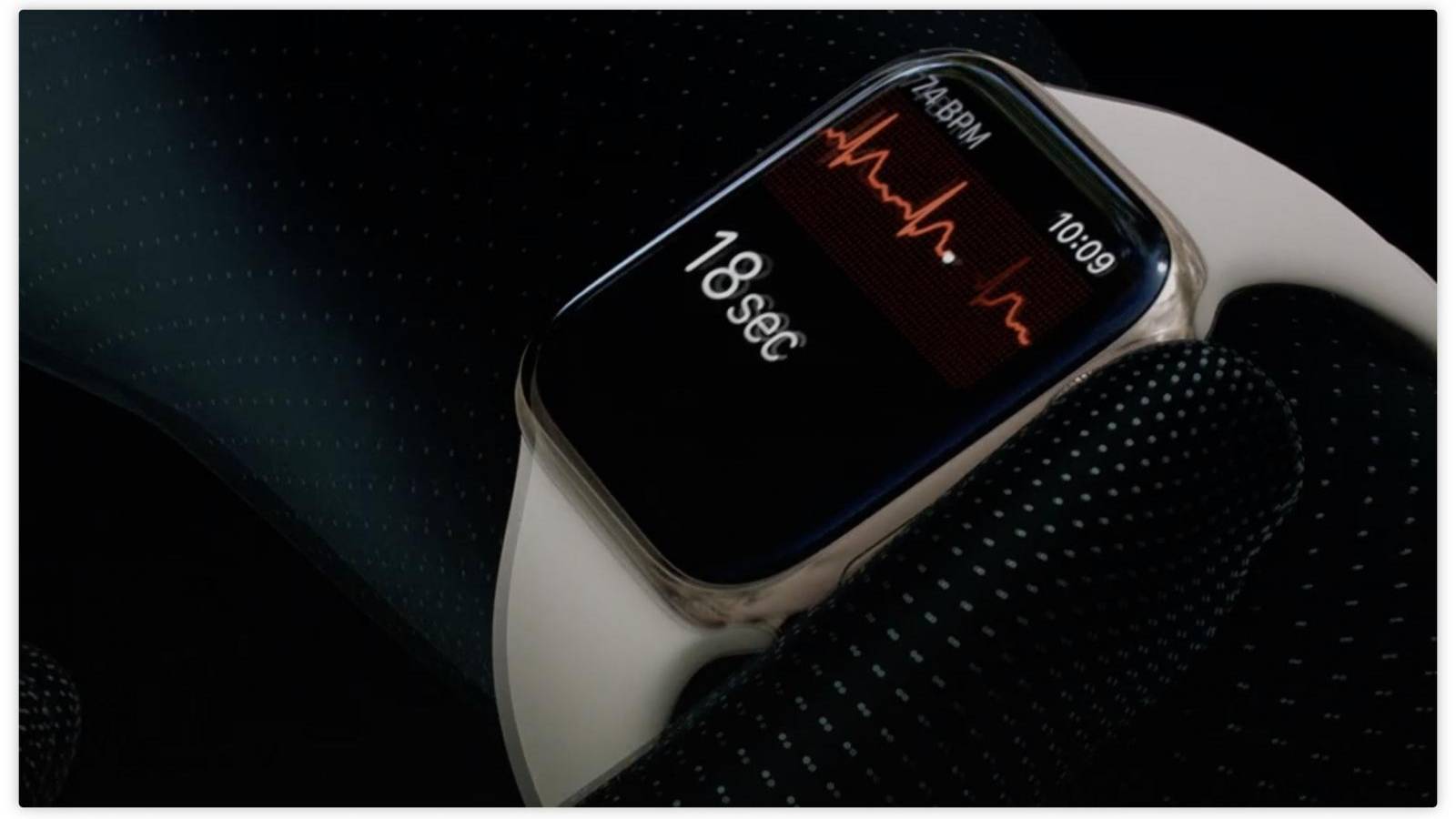 Apple Watch ECG detects evidence of a heart condition missed by ...